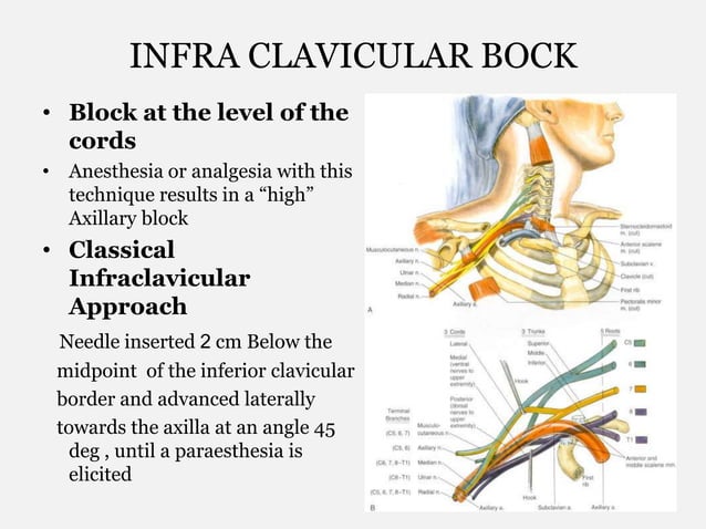 brachial plexus blocks | PPT