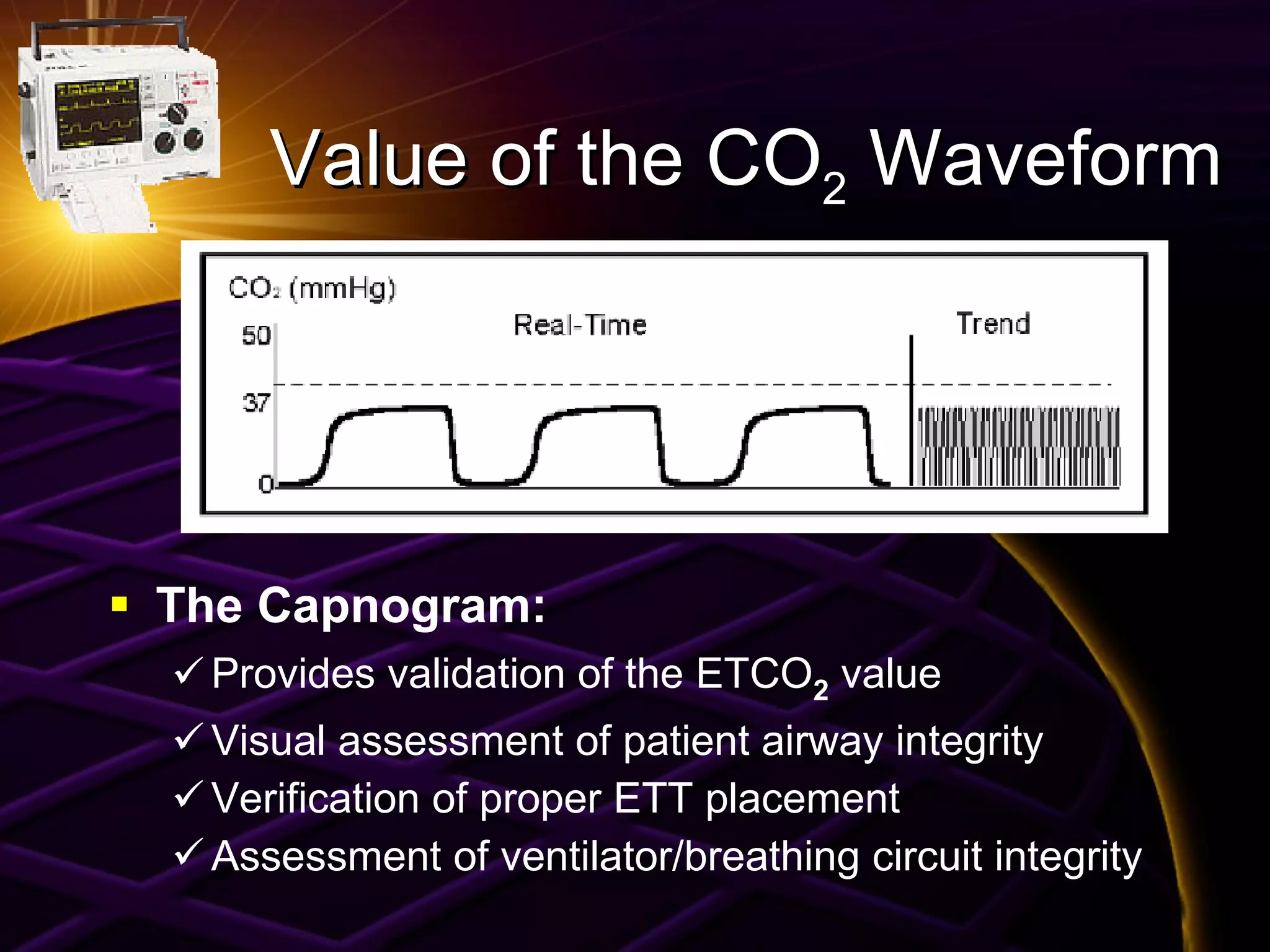 01 capnography the new standard of care | PPT