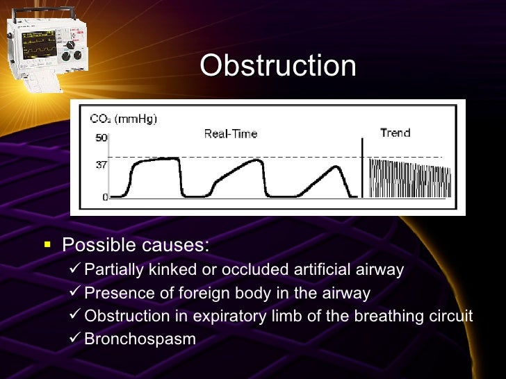 01 capnography the new standard of care