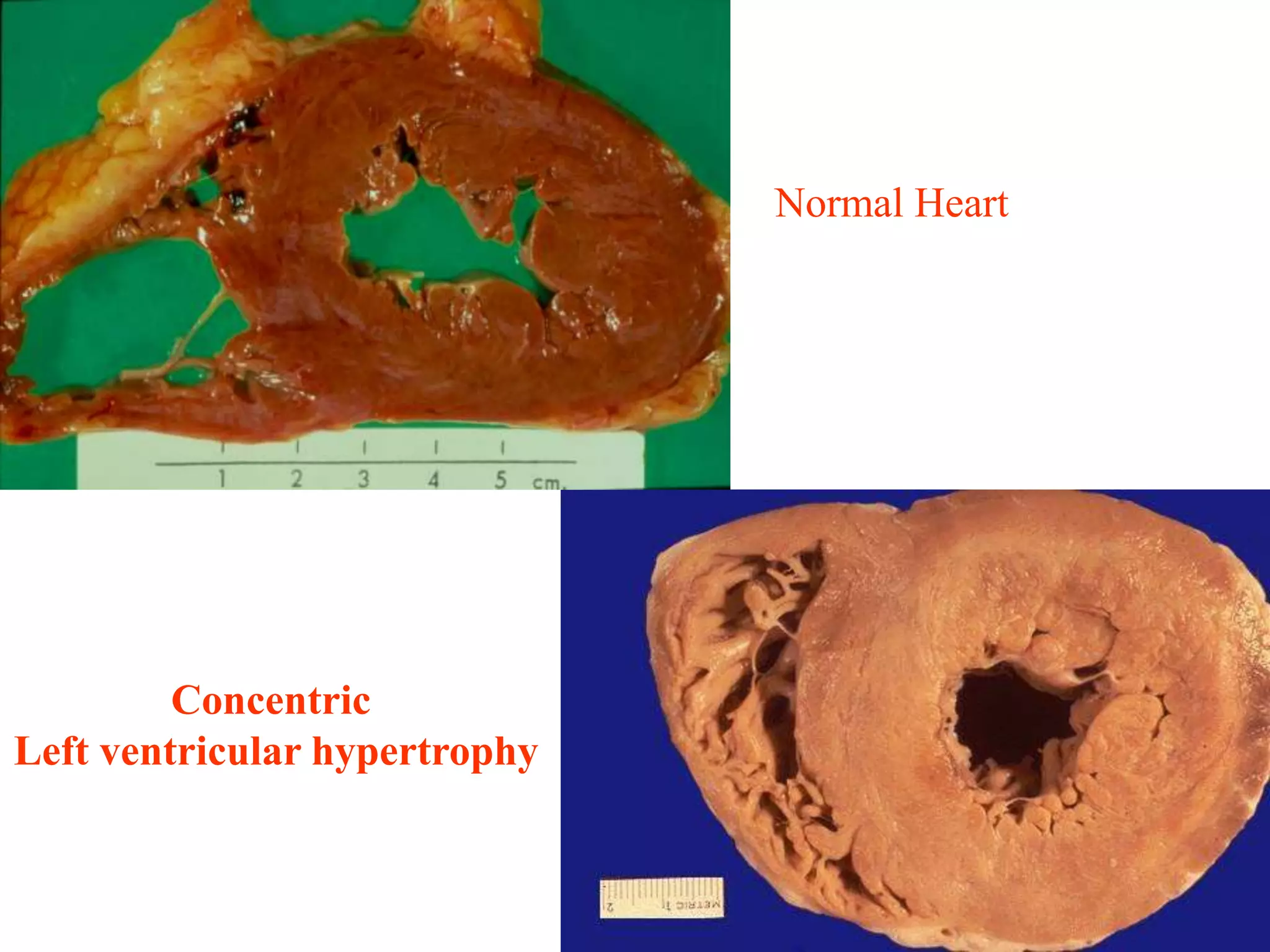 01 cardiac pathology | PPT