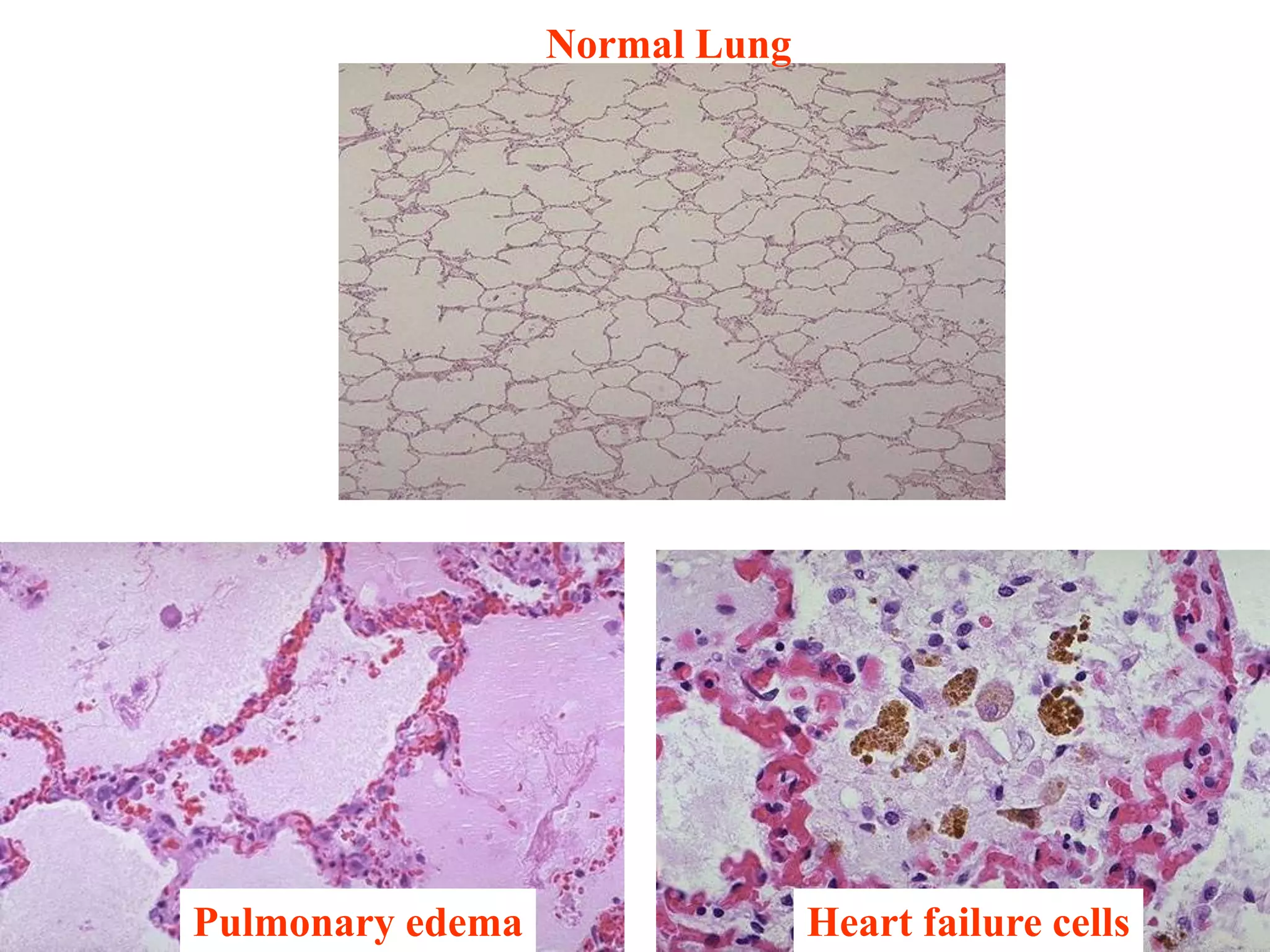 01 cardiac pathology | PPT