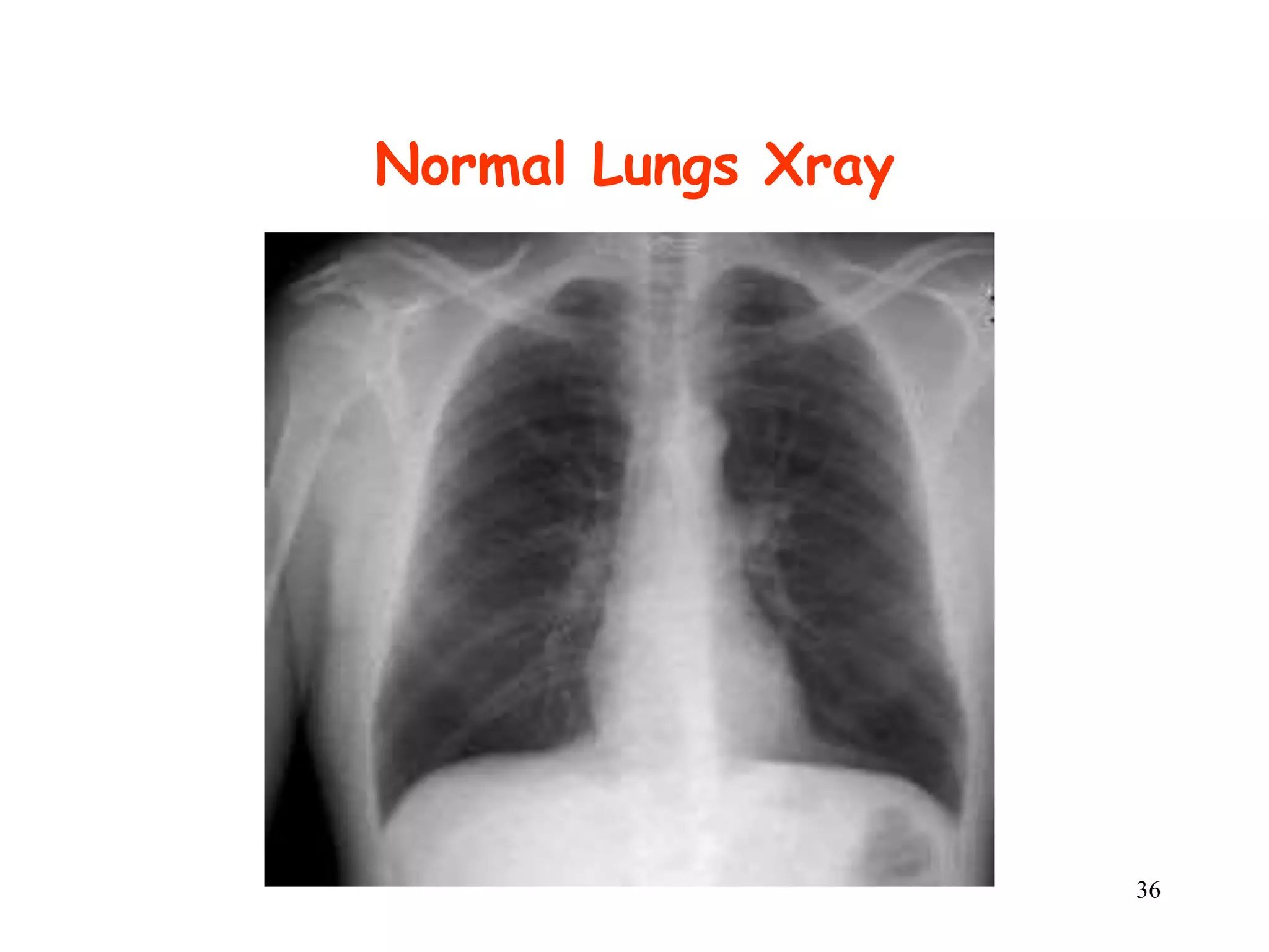 01 cardiac pathology | PPT