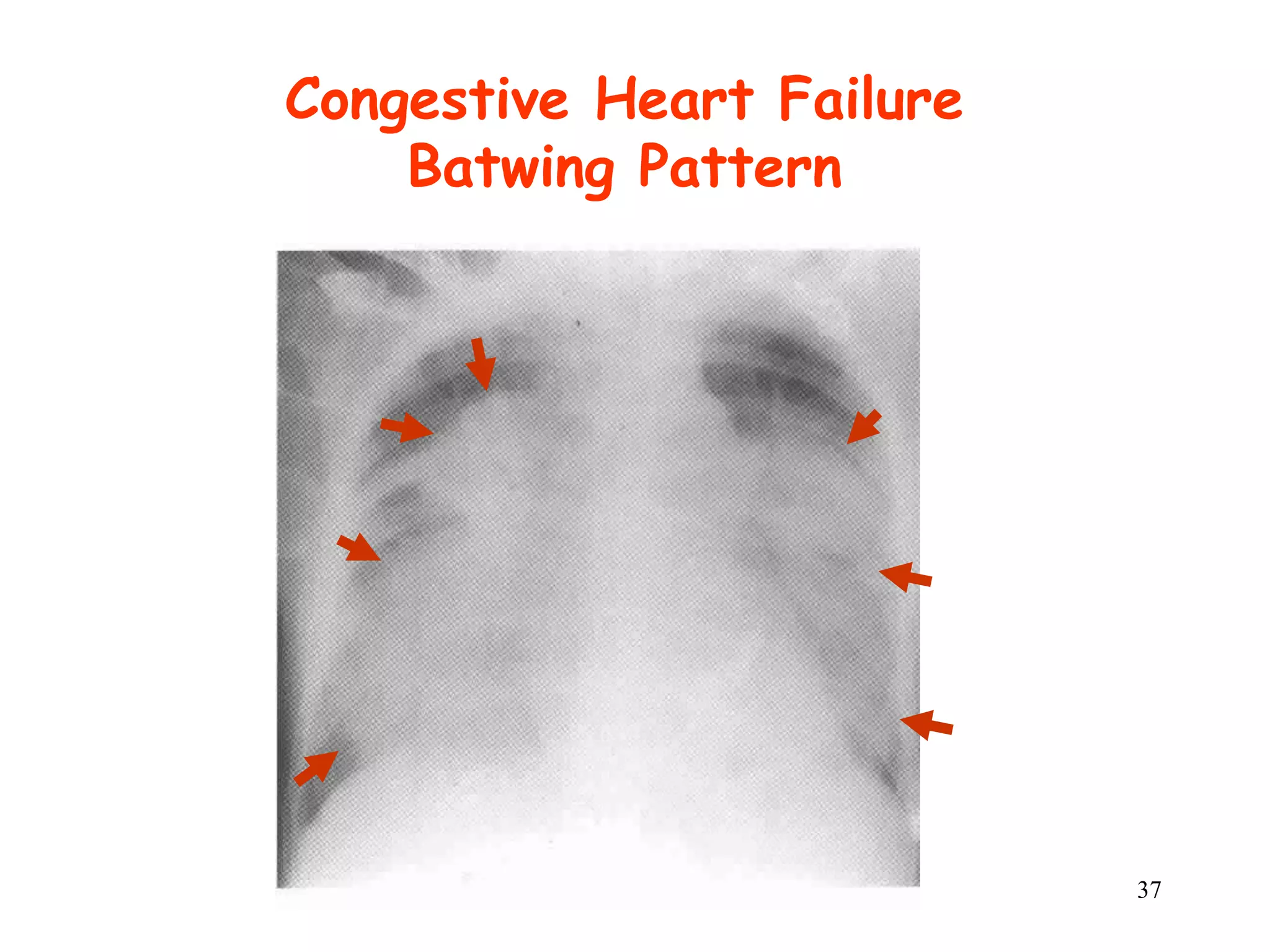 01 cardiac pathology | PPT