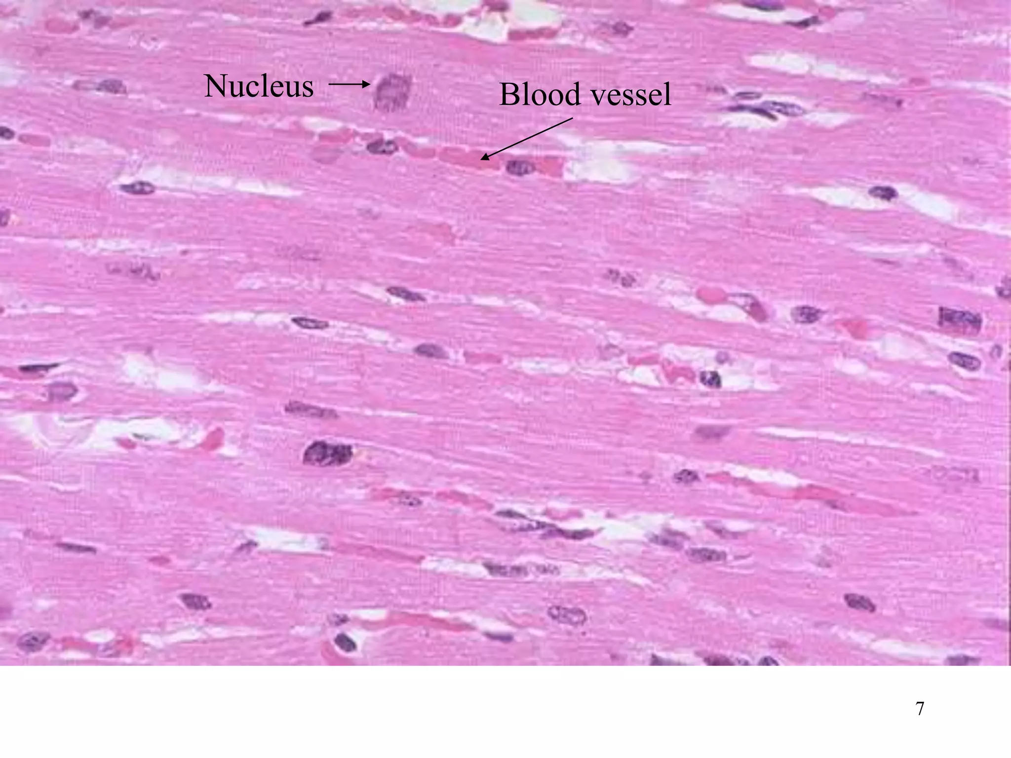 01 cardiac pathology | PPT