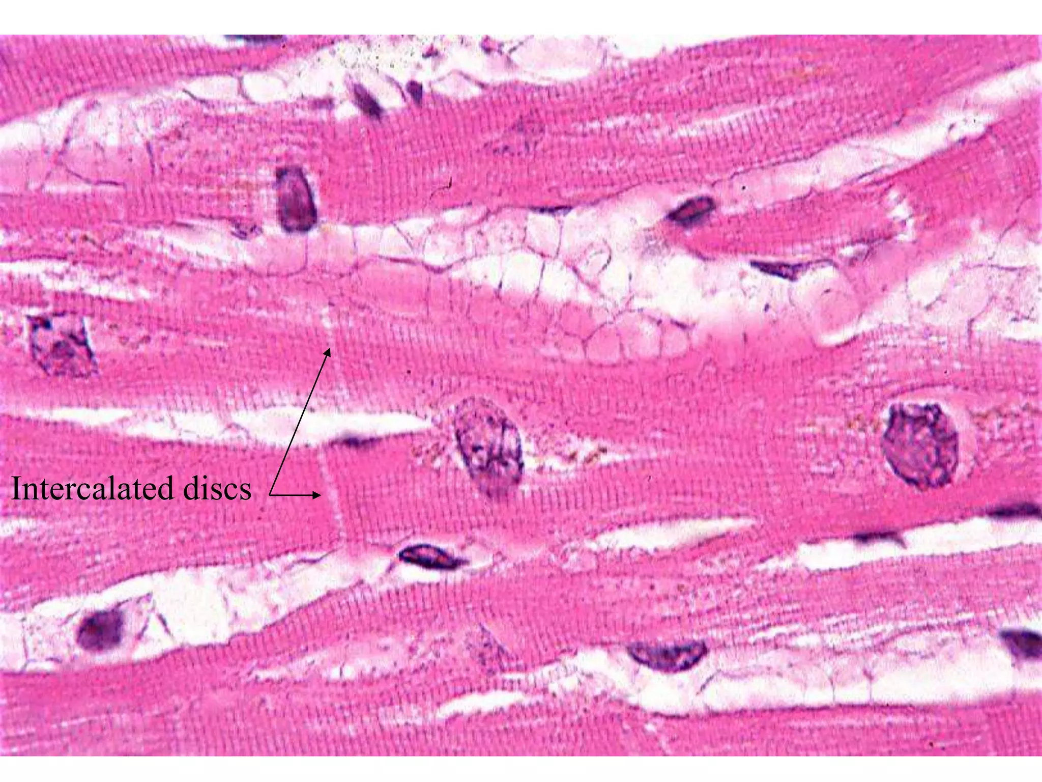 01 cardiac pathology | PPT | Free Download