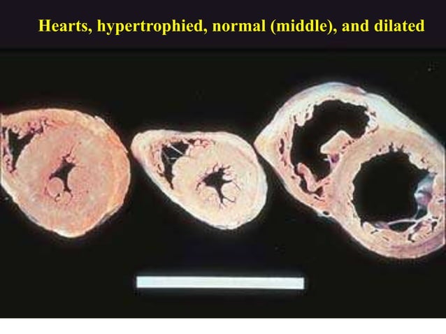 01 cardiac pathology | PPT | Free Download