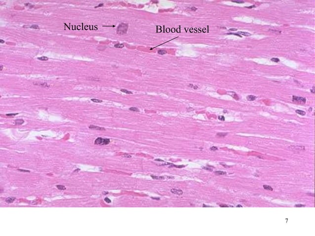 01 cardiac pathology | PPT