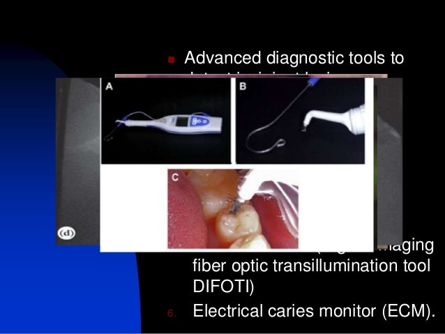 conservative approach OPERATIVE DENTISTRY