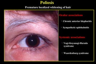 disorders of lashes | PPT