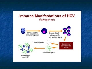 Extrahepatic Manifestations of HCV | PPT