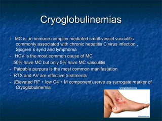 Extrahepatic Manifestations of HCV | PPT