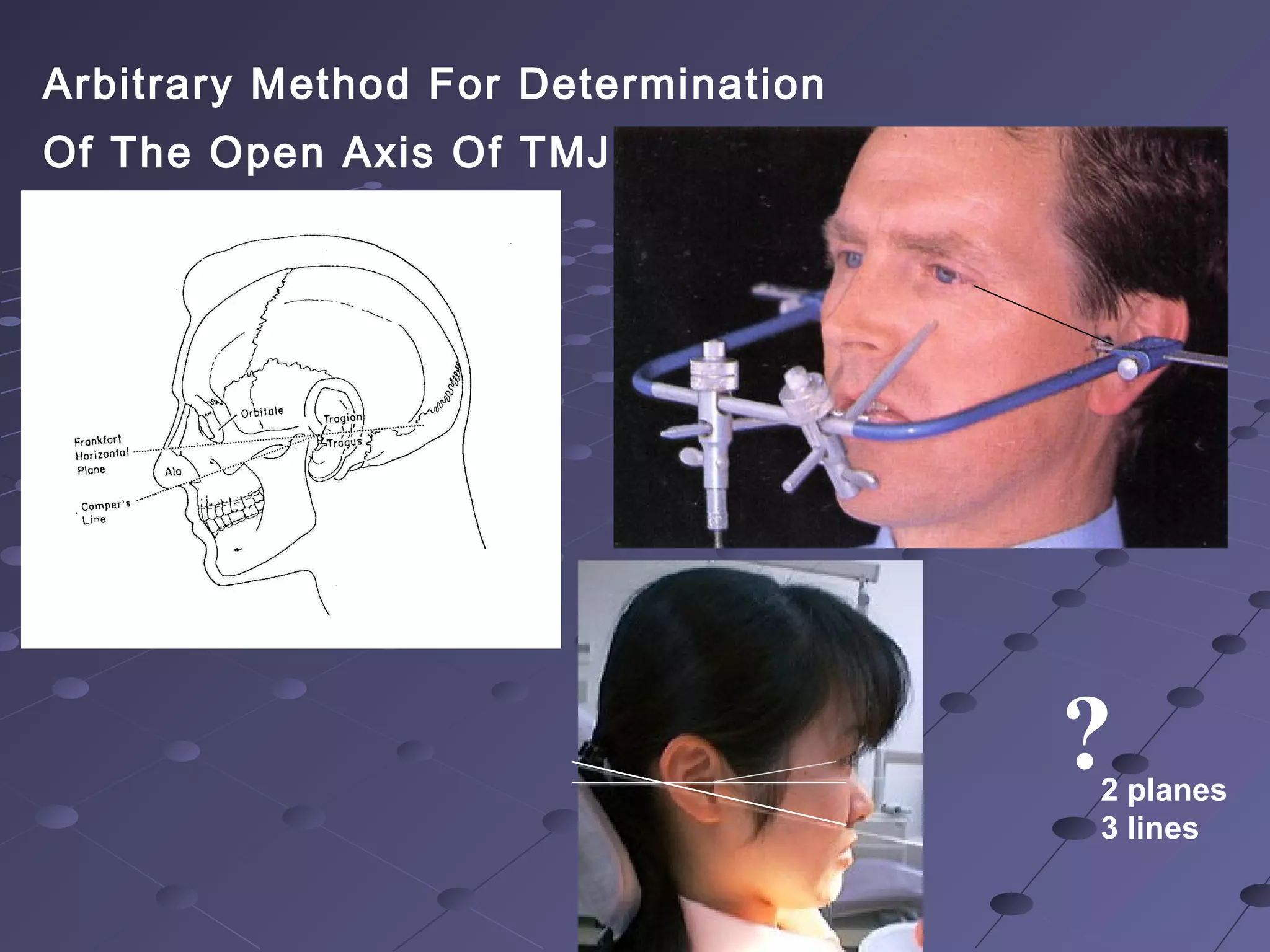 01 facebows and Articulators | PPT