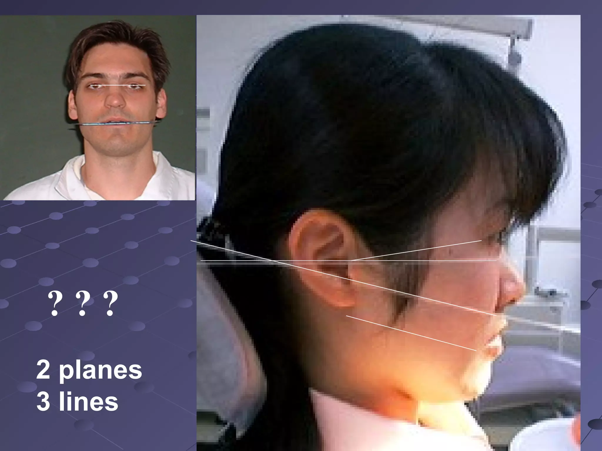 01 facebows and Articulators | PPT