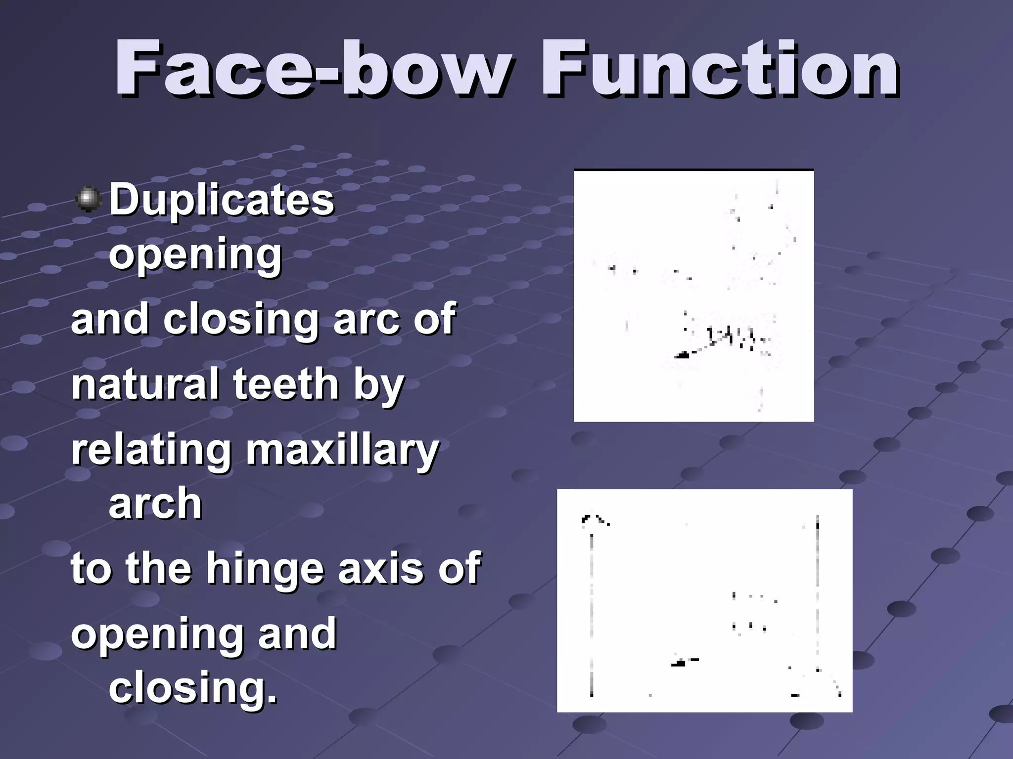 01 facebows and Articulators | PPT
