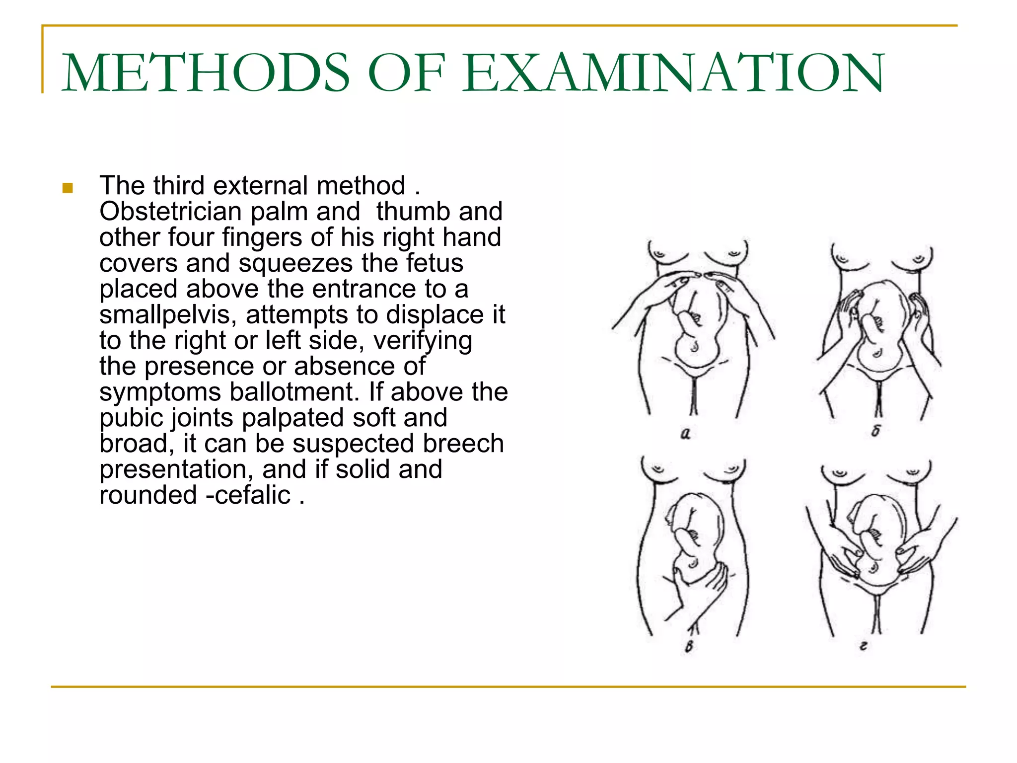01_Female pelvis. Fetus as object of delivery ...