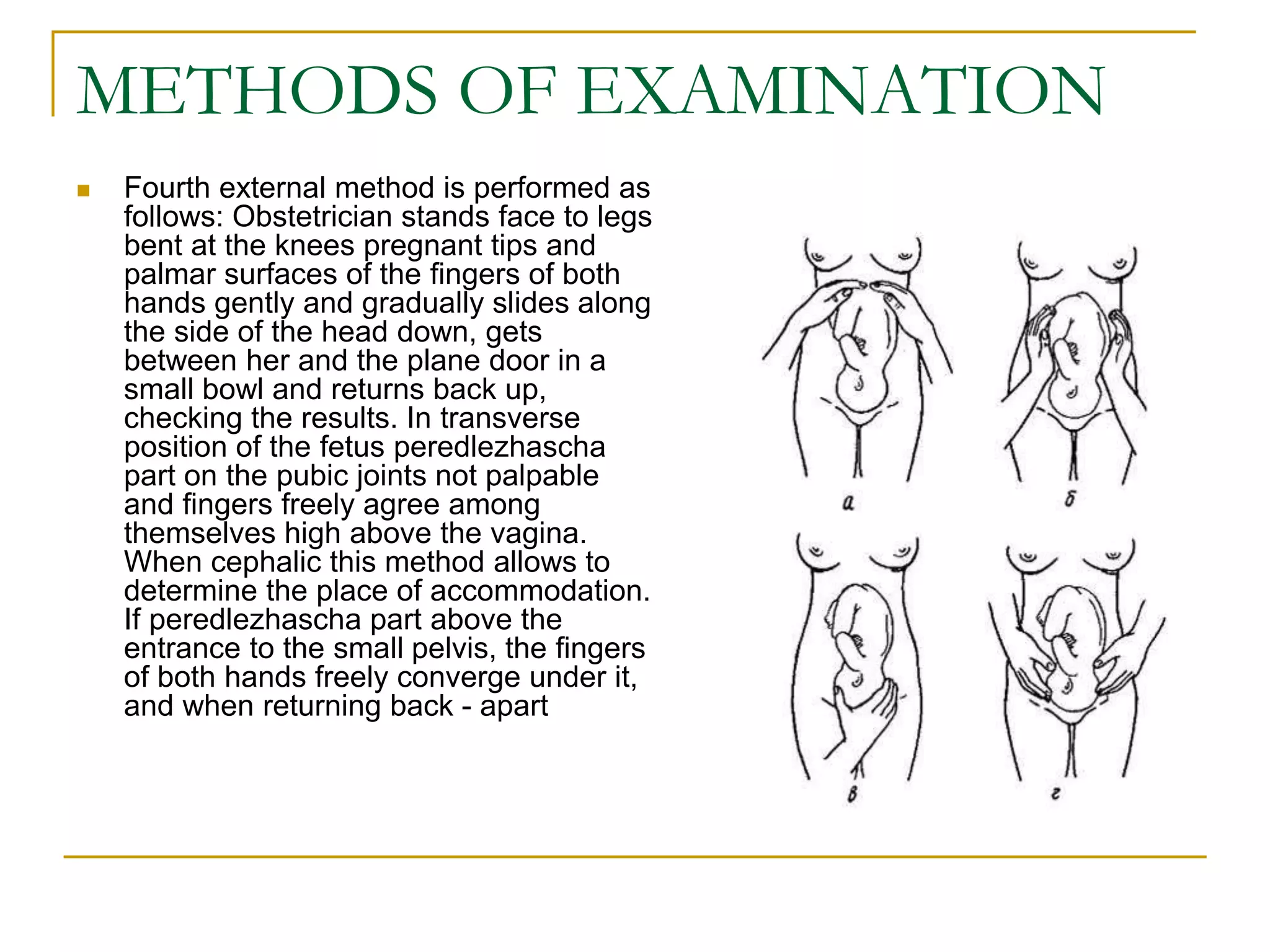01_Female pelvis. Fetus as object of delivery ...
