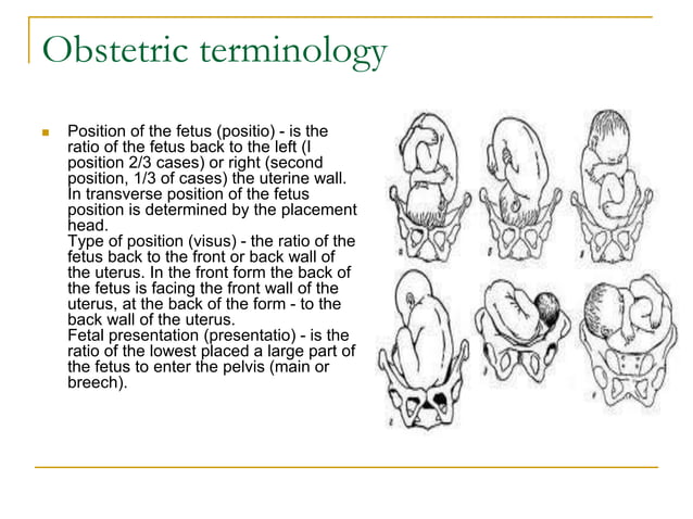 01_Female pelvis. Fetus as object of delivery ...