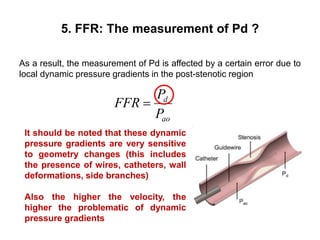 01 FFR Mongrain aimradial2017 - coronary blood flow | PPTX | Heart and ...