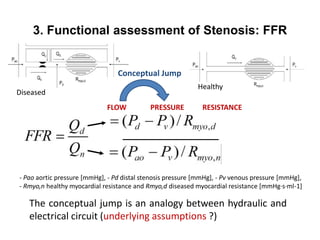 01 FFR Mongrain aimradial2017 - coronary blood flow | PPTX | Heart and ...