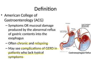 01Gastroesophageal Reflux Disease (GERD).ppt