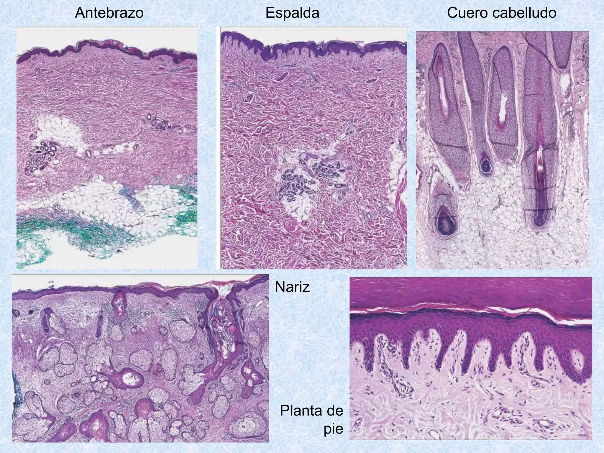 01 HISTOLOGÍA DE LA PIEL.ppt | Skin and Dermatology | Diseases and ...