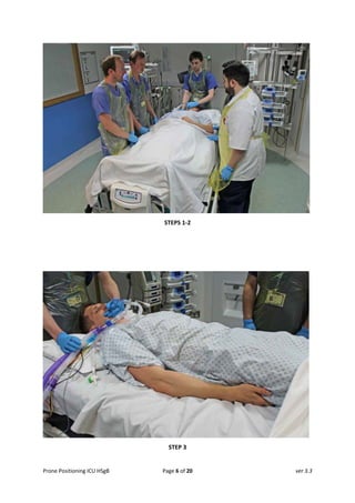 Prone Positioning in the Intubated Adult ICU Patient | PDF