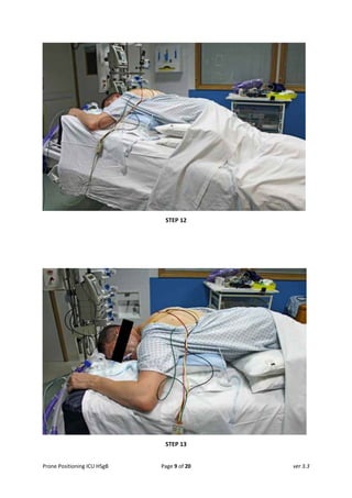 Prone Positioning in the Intubated Adult ICU Patient | PDF