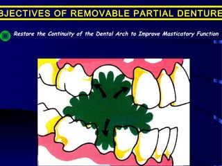 01 introduction and objectives of rpd | PPT | Dental Health | Diseases ...