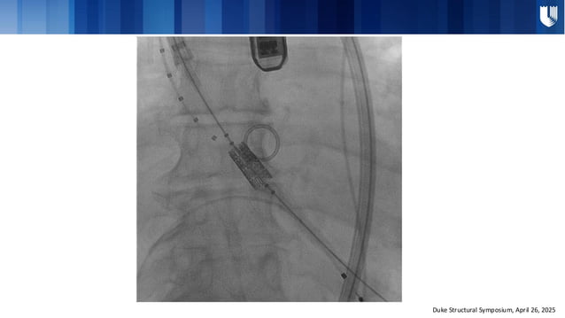 Current State of Transcatheter Aortic Valve Replacement (TAVR) | PPT
