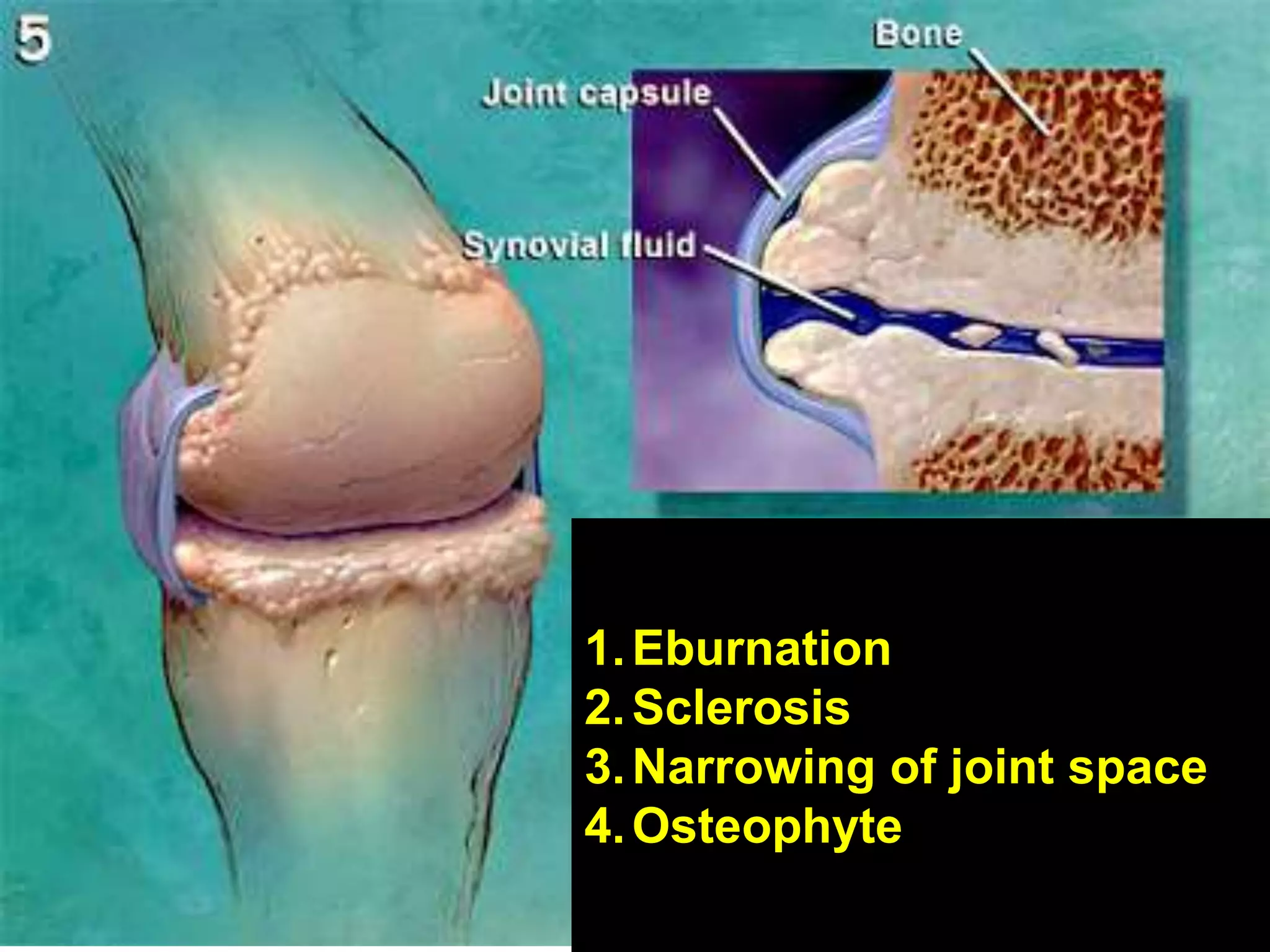 joint disorders part 1 | PPT