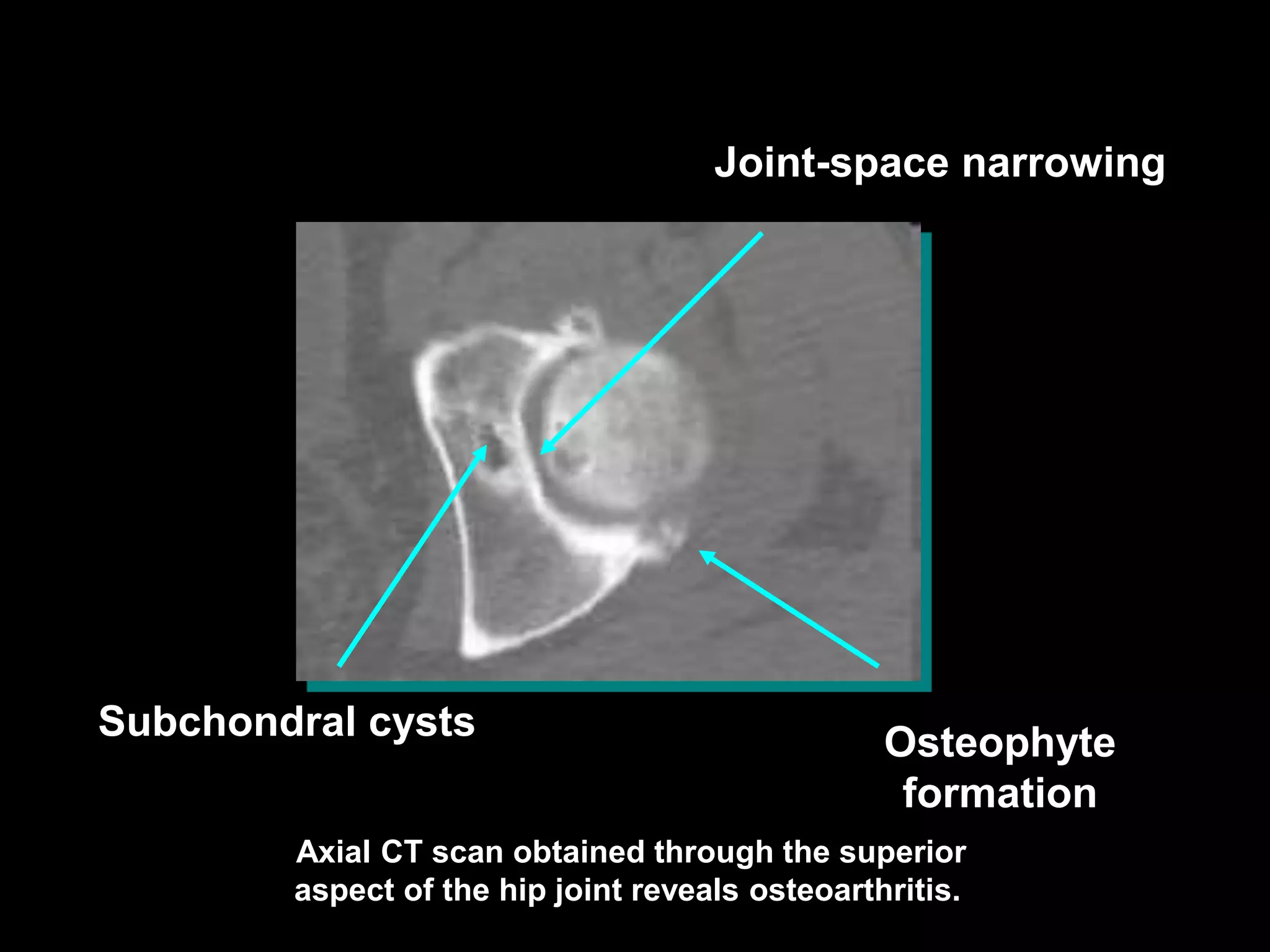 joint disorders part 1 | PPT