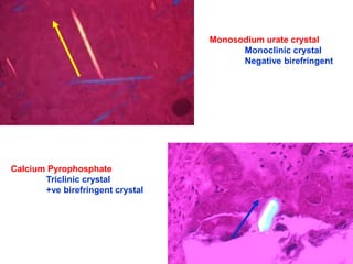 joint disorders part 1 | PPT