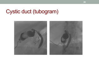 Liver and biliary tract anatomy, 2018, by R. Lunevicius | PDF