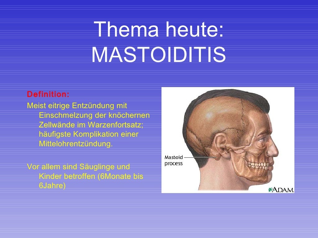 01 mastoiditis