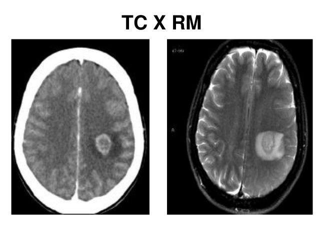 Meios de Contraste na RM