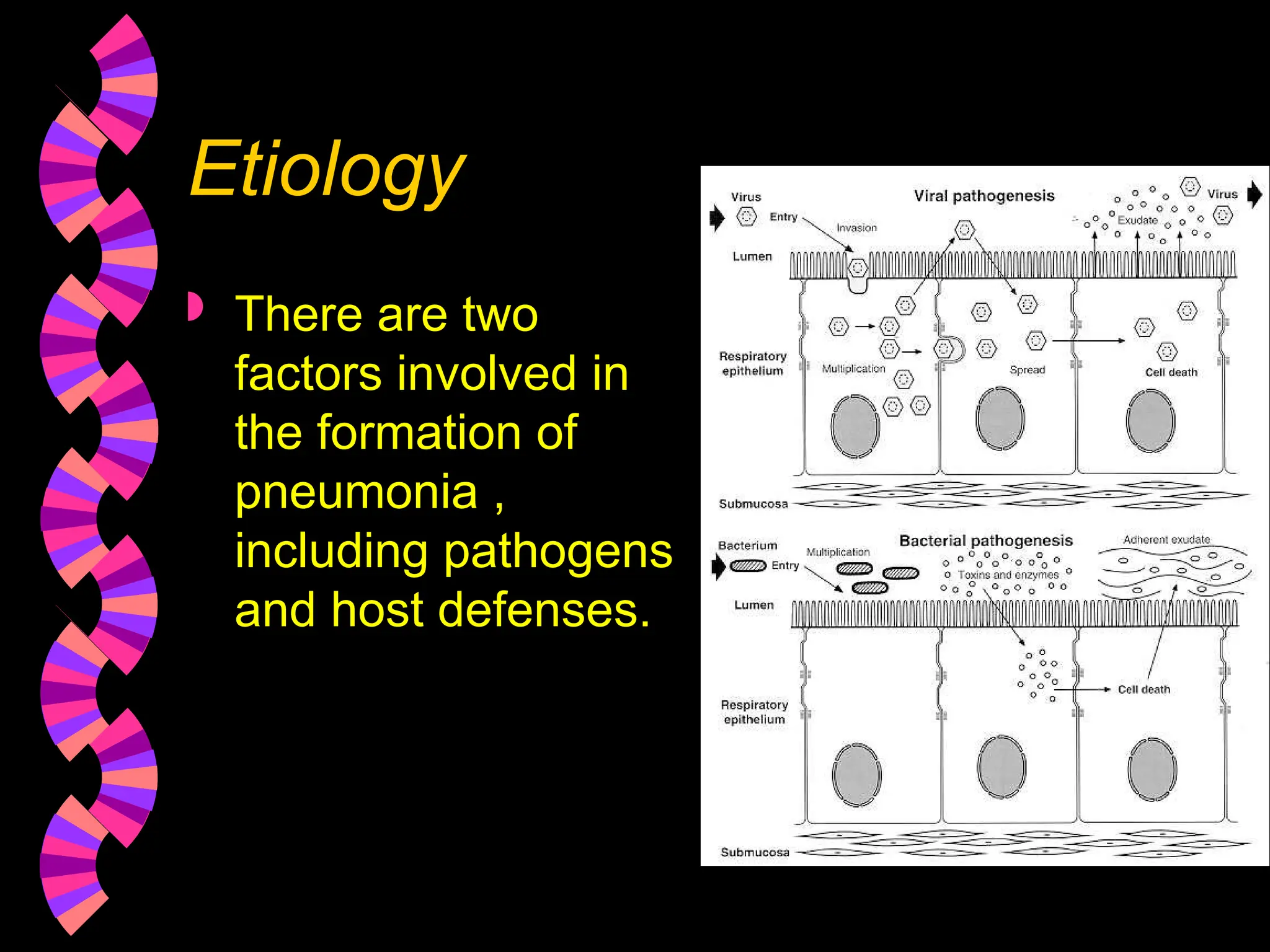 01 Pneumonia and its classifications.ppt