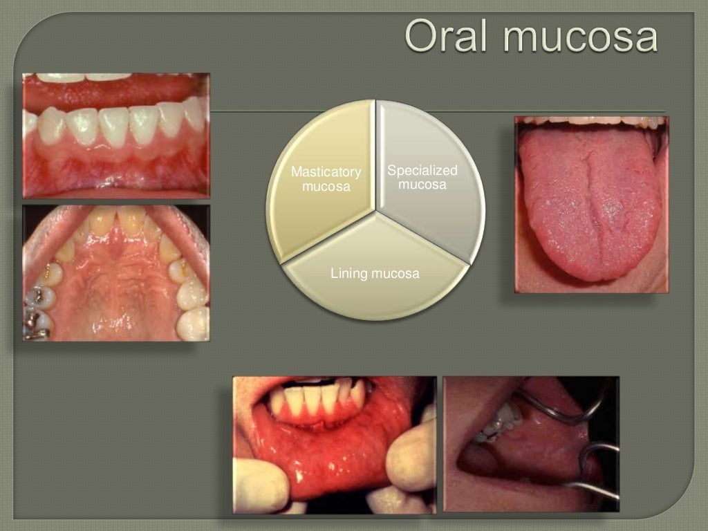 Red lesion of oral mucosa