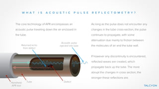 An Overview of Acoustic Pulse Reflectometry | PDF
