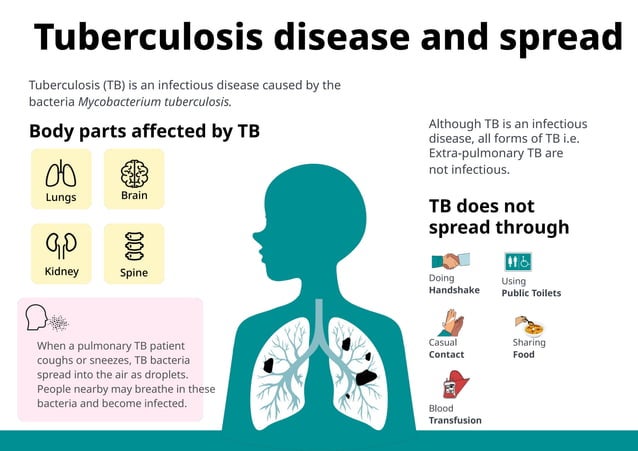 01 TB Clinical Overview (3).pptx for overview | PPT