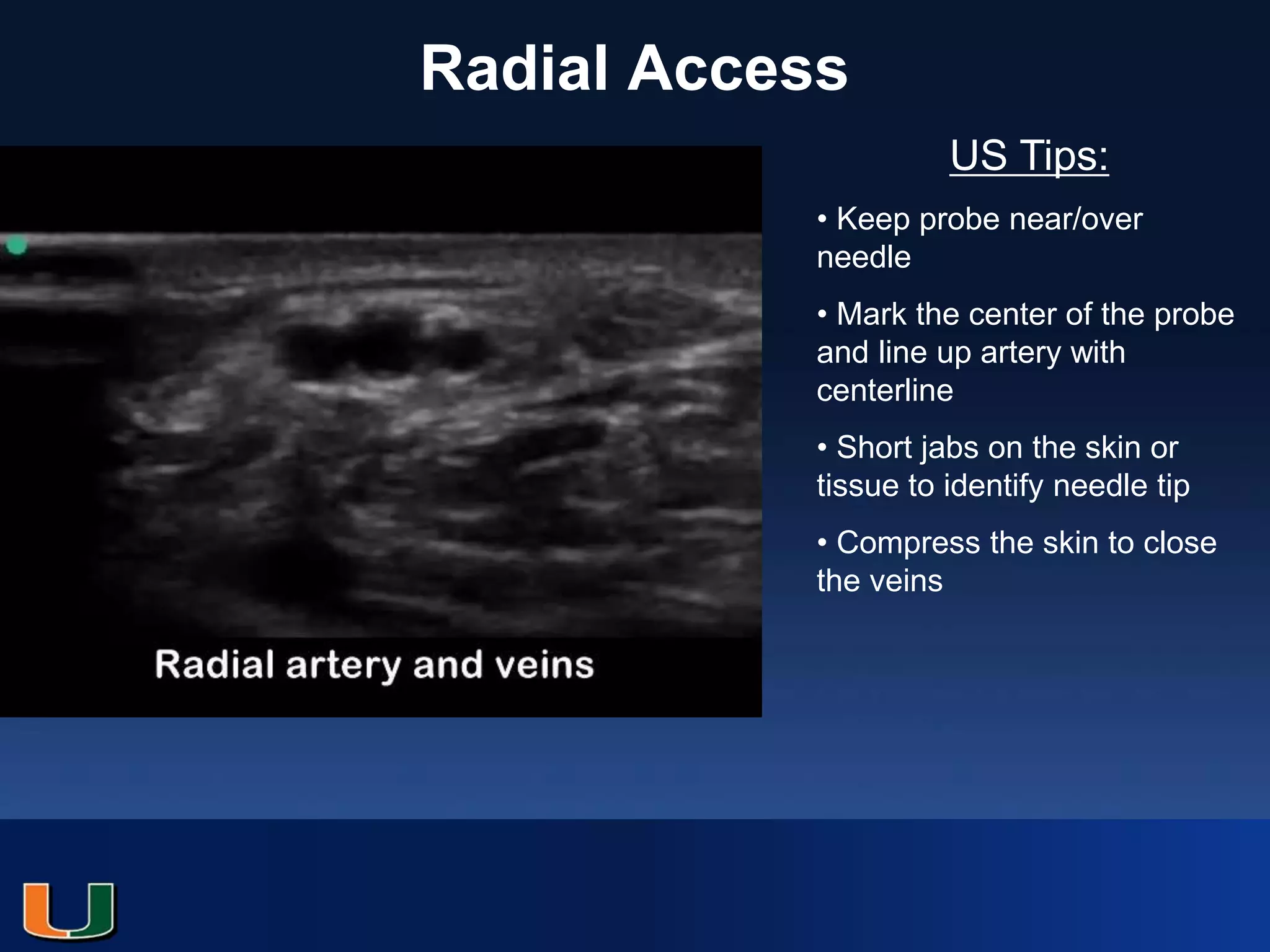 01 technical Cohen aimradial20170922 Ultrasound based puncture | PPT
