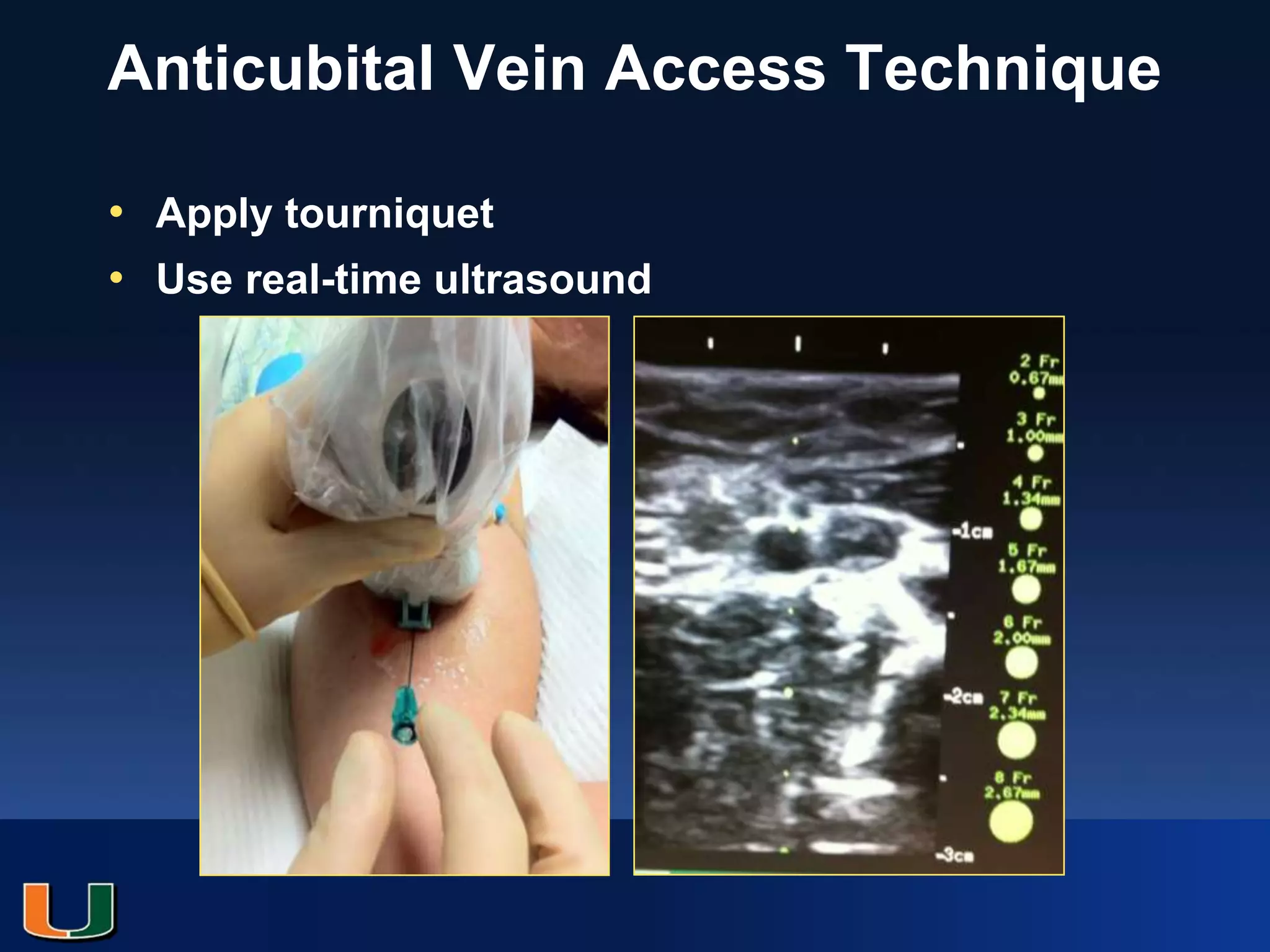01 technical Cohen aimradial20170922 Ultrasound based puncture | PPT