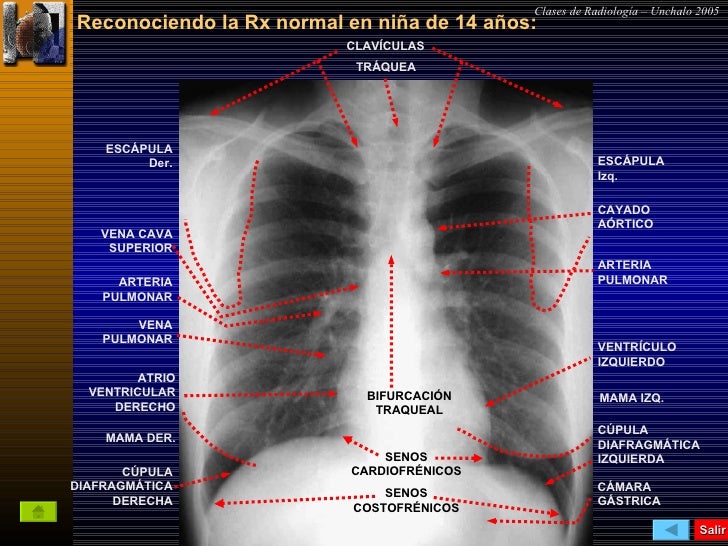 Como interpretar una rx en pediatría.