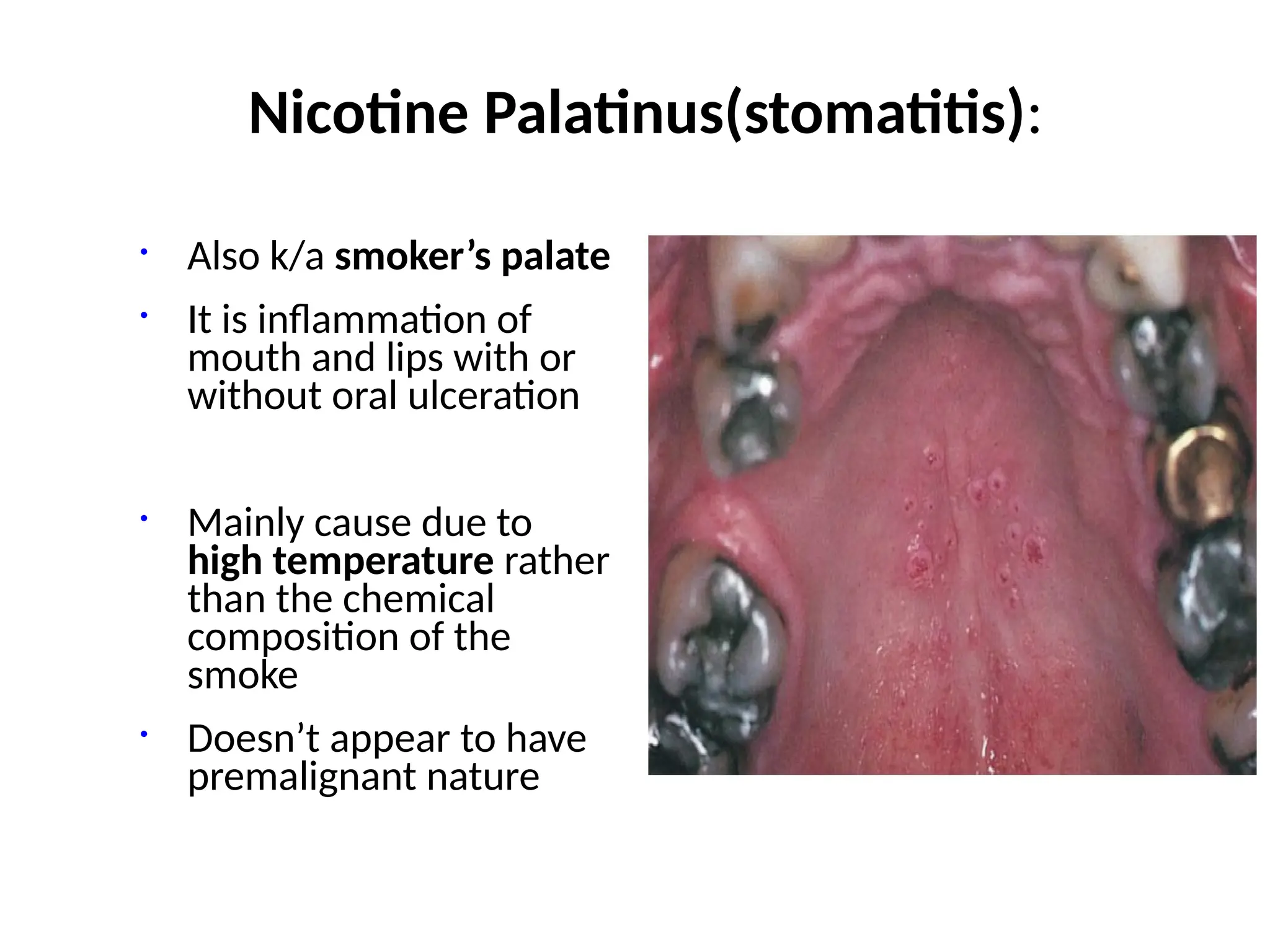 01 Tobacco & its effect on oral cavity.pptx