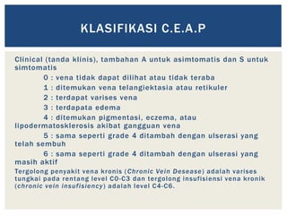 01 varises khilda sp.B.pptx