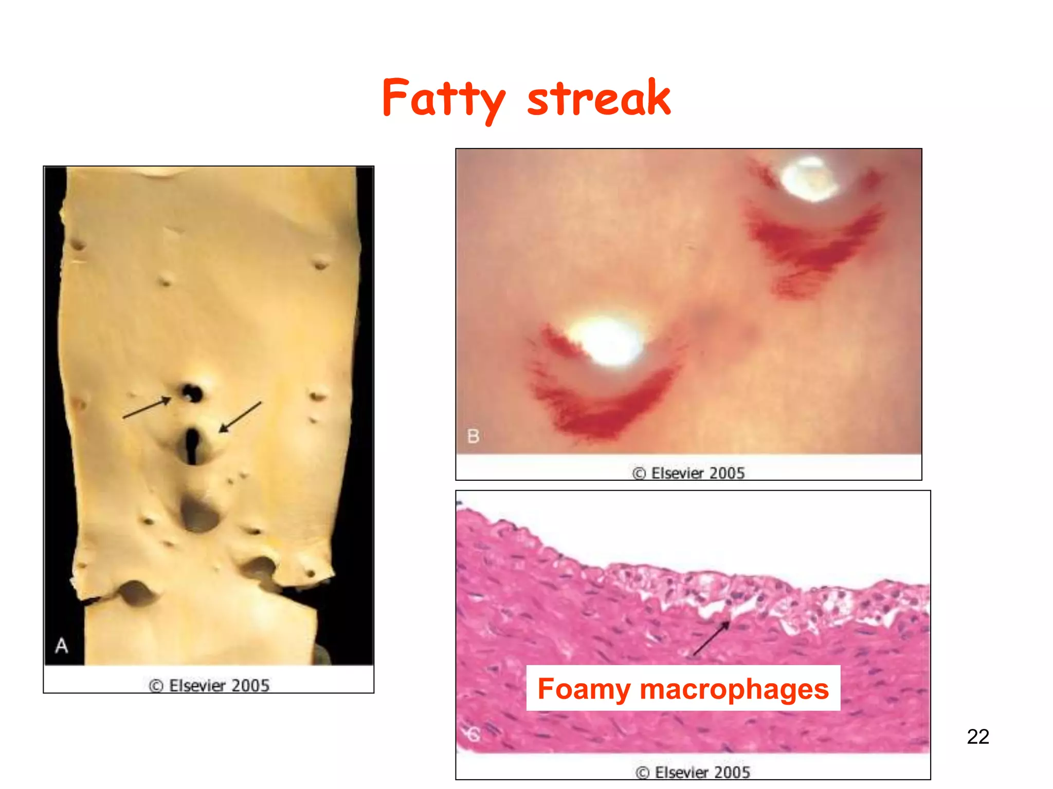 01 vascular pathology | PPT