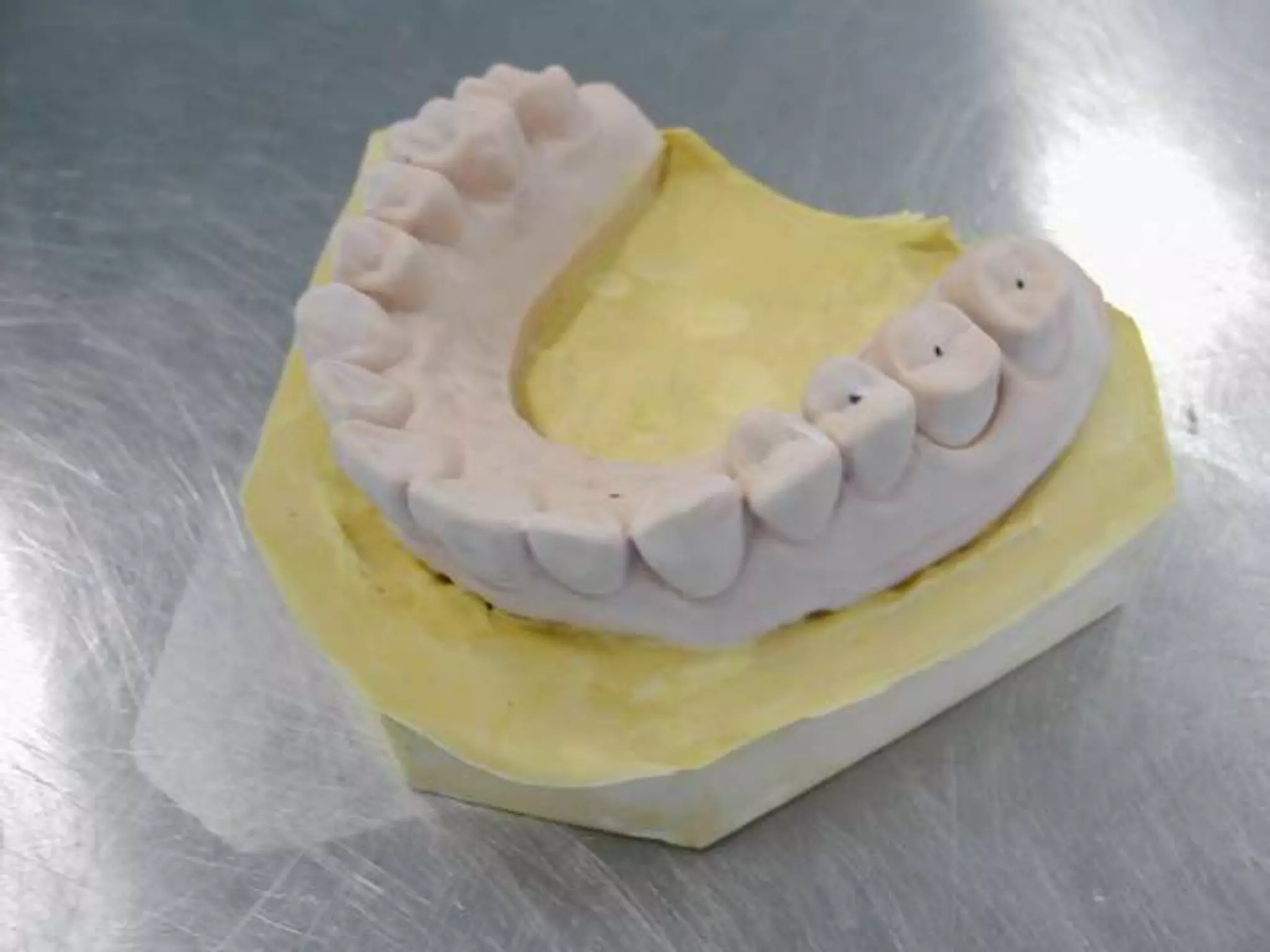 02 02 sectioning a crown model | PPTX