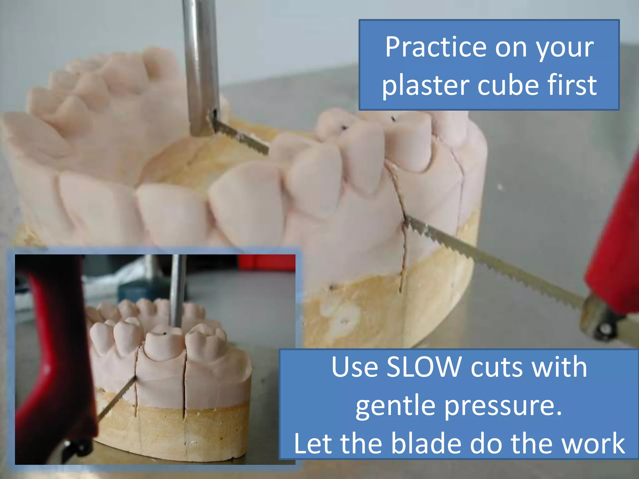 02 02 sectioning a crown model | PPTX