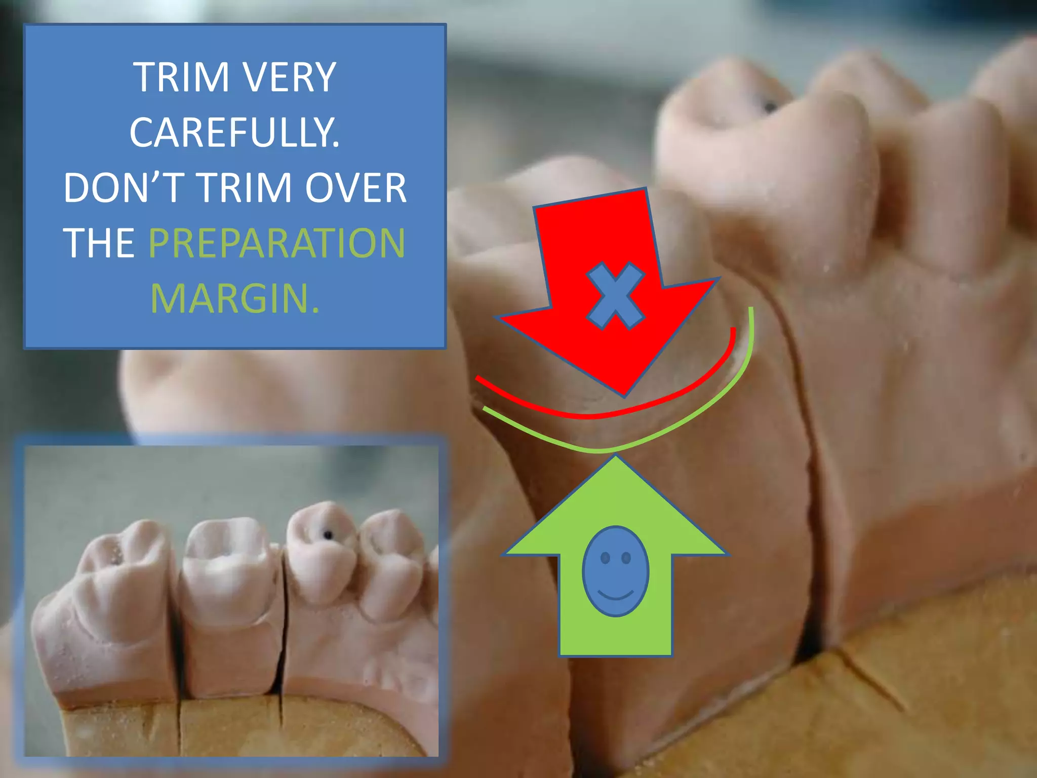 02 02 sectioning a crown model | PPTX