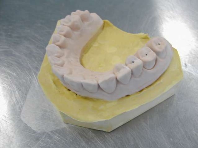 02 02 sectioning a crown model | PPTX