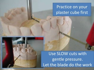 02 02 sectioning a crown model | PPTX